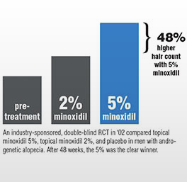 How to apply Minoxidil? | Best way to use Minoxidil | Minoxidil Spray